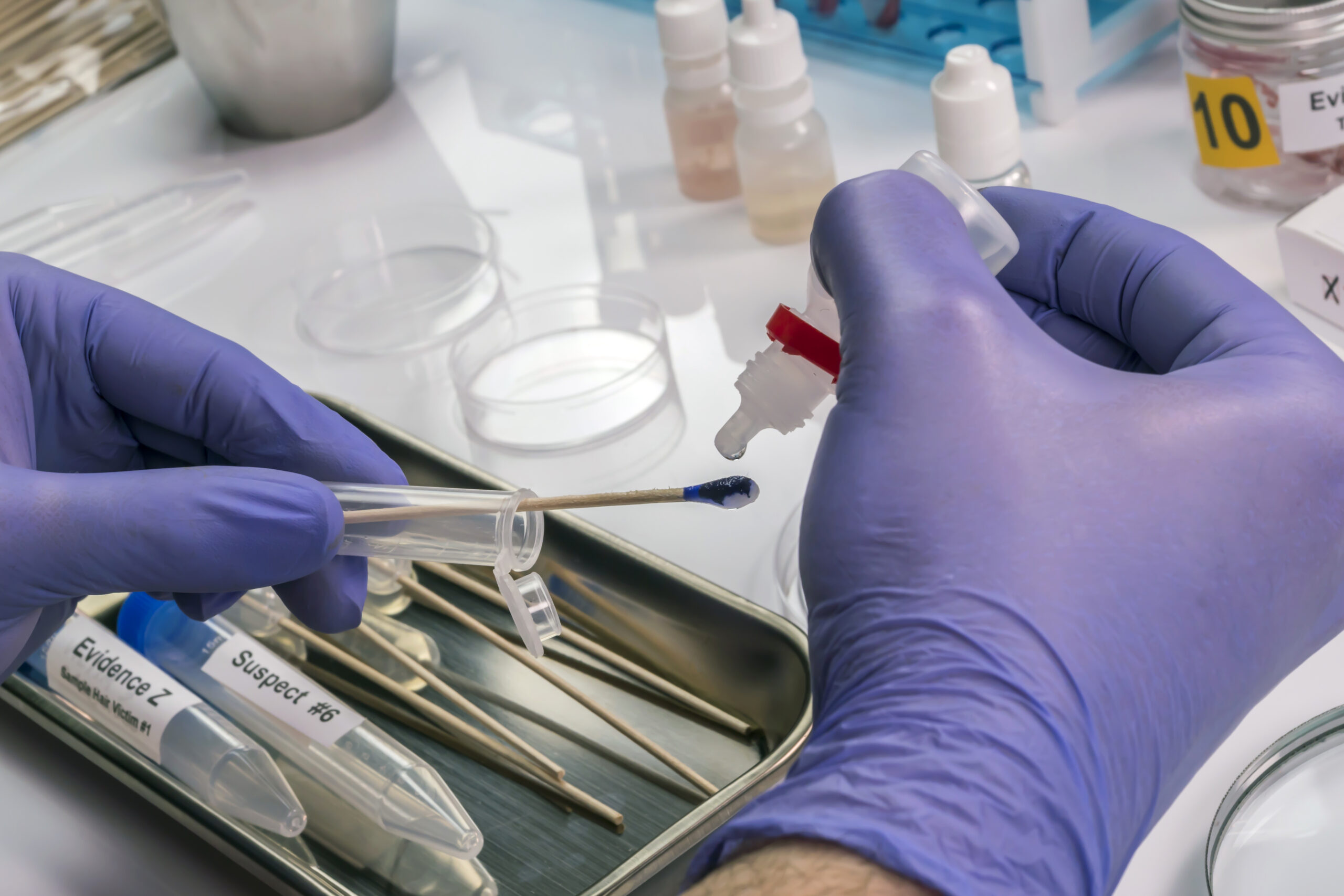 Haematology - Endoglobal