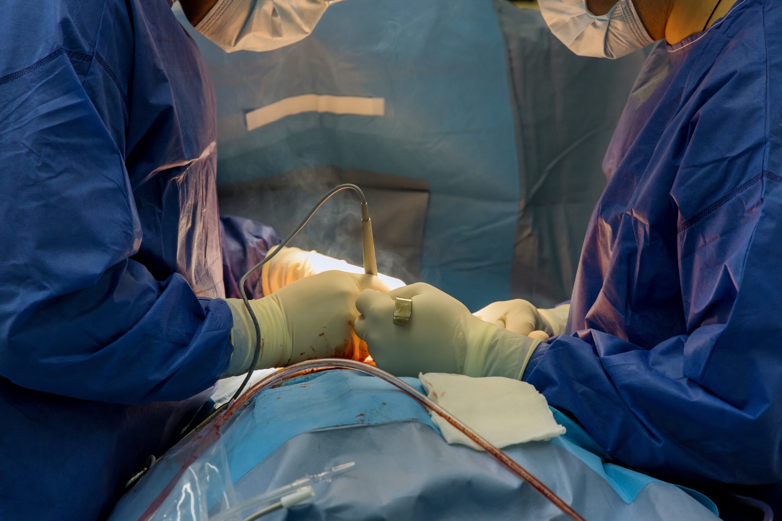 Vascular Surgery - Endoglobal